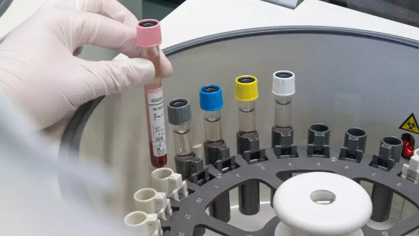 Bio-Rad Immunohematology